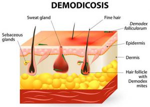 Infected Eyelash · Top Eye Specialist · Optometrist, Ophthalmologist NYC